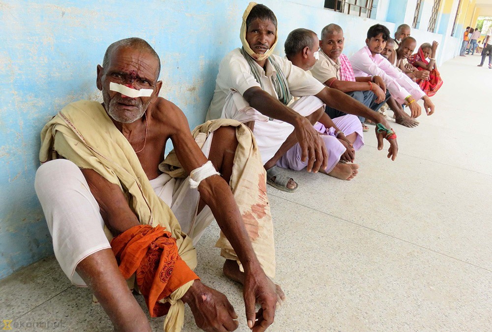 Jackal terror in Rautahat: 40 wounded