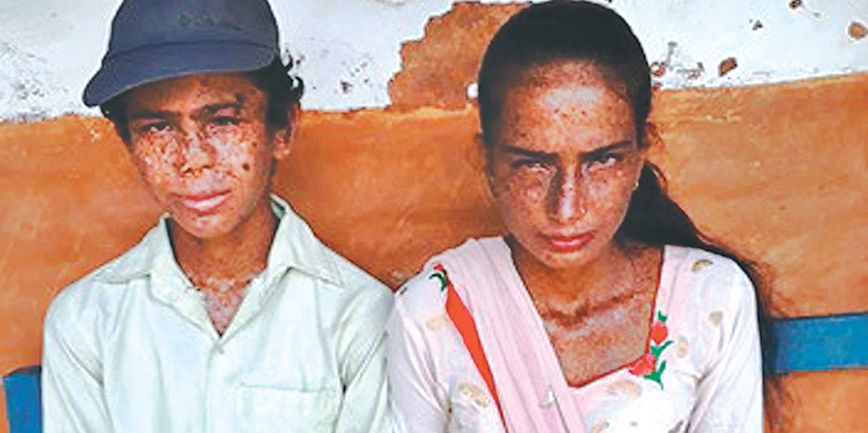 Father appeals for help to treat two children with skin cancer