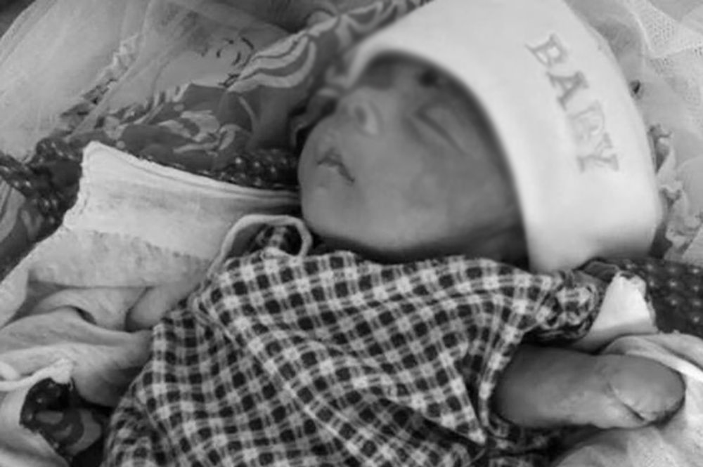 New-born baby's hand amputated after month-long treatment, relatives ...