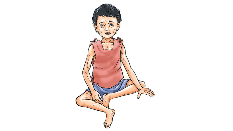 Micronutrients deficiency high: Report