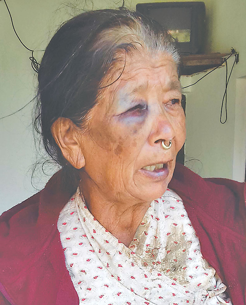 Assault on elderly: Three arrested for force-feeding faeces