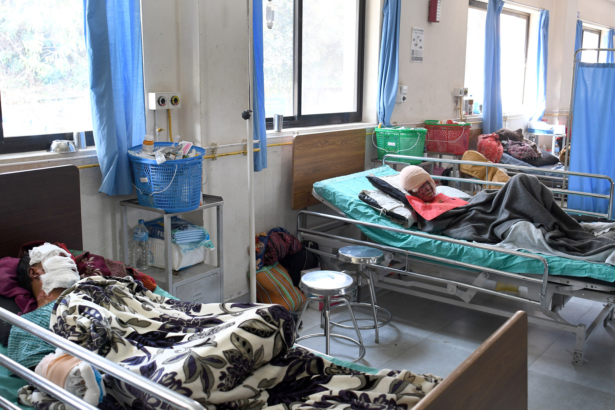 Number of burn victims is rising at an alarming rate, but the country ...